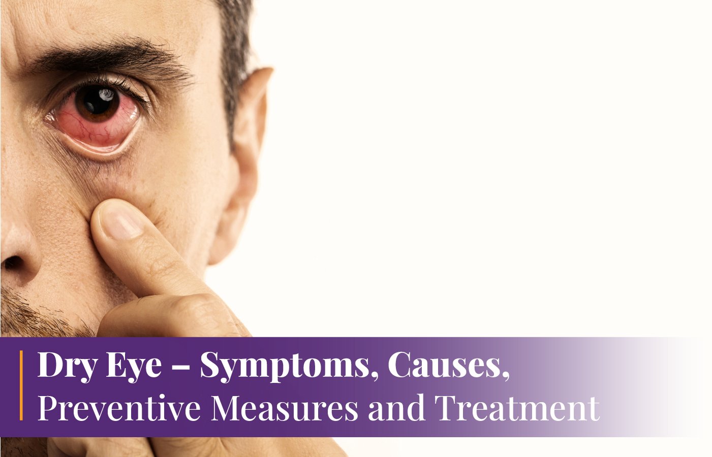 Dry Eye – Symptoms, Causes, Preventive Measures and Treatment