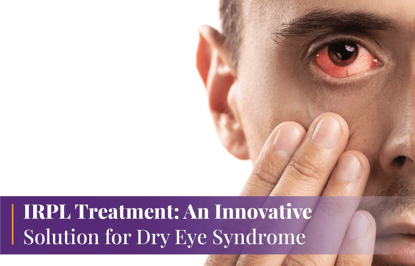 IRPL Treatment: An Innovative Solution for Dry Eye Syndrome - Welcome ...